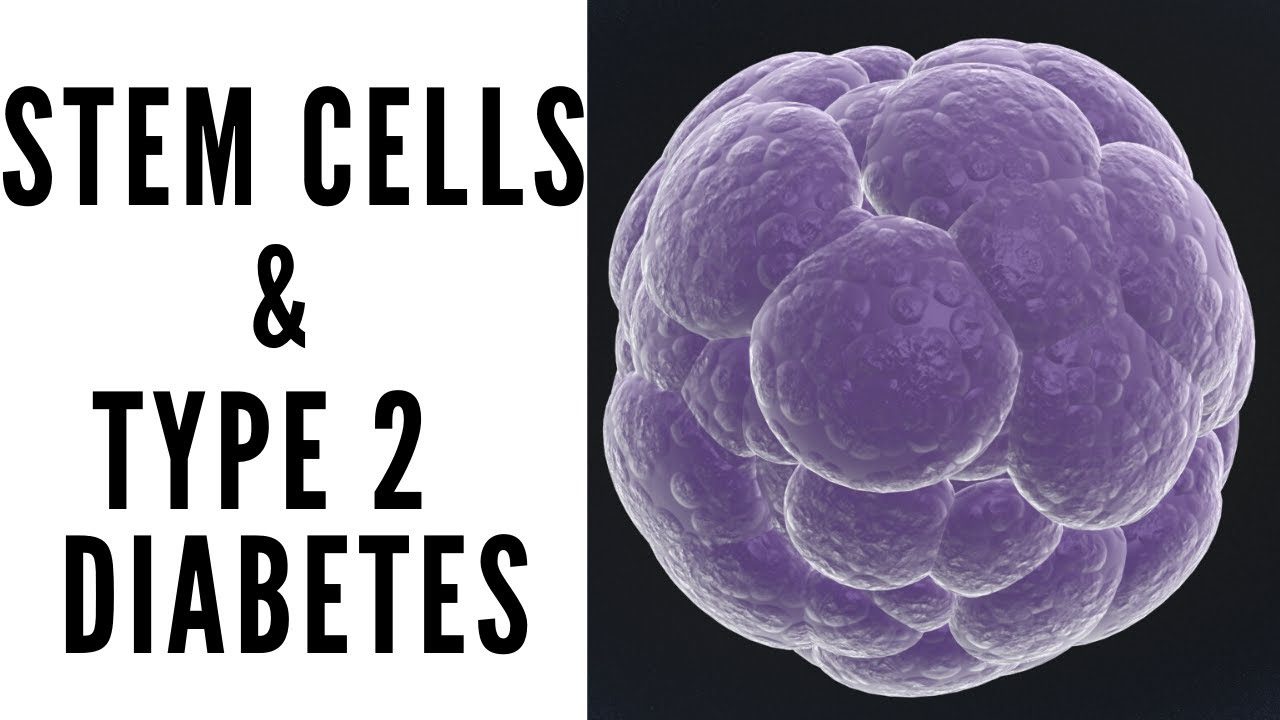 Episode #38 - Stems Cells & Type 2 Diabetes- Fix Blood Sugar Webinar ...